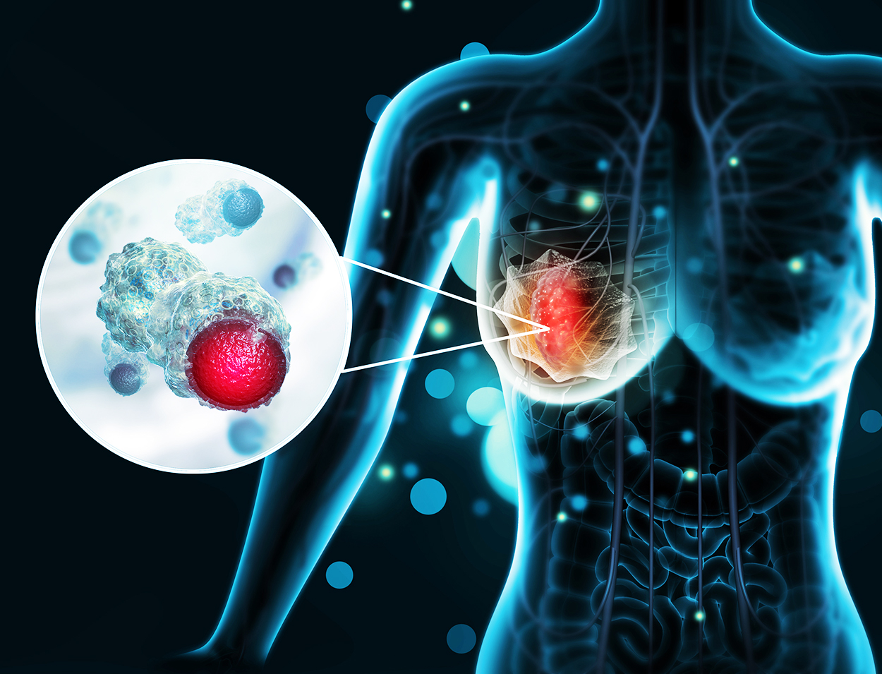 Know About the Chemicals Linked to Breast Cancer